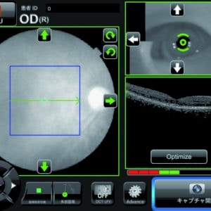 OCT500 Advanced Robotic OCT - Essilor Instruments USA