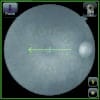 OCT500 Advanced Robotic OCT - Essilor Instruments USA