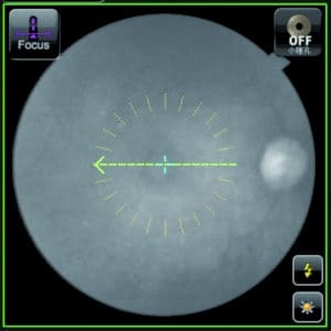 OCT500 Advanced Robotic OCT - Essilor Instruments USA