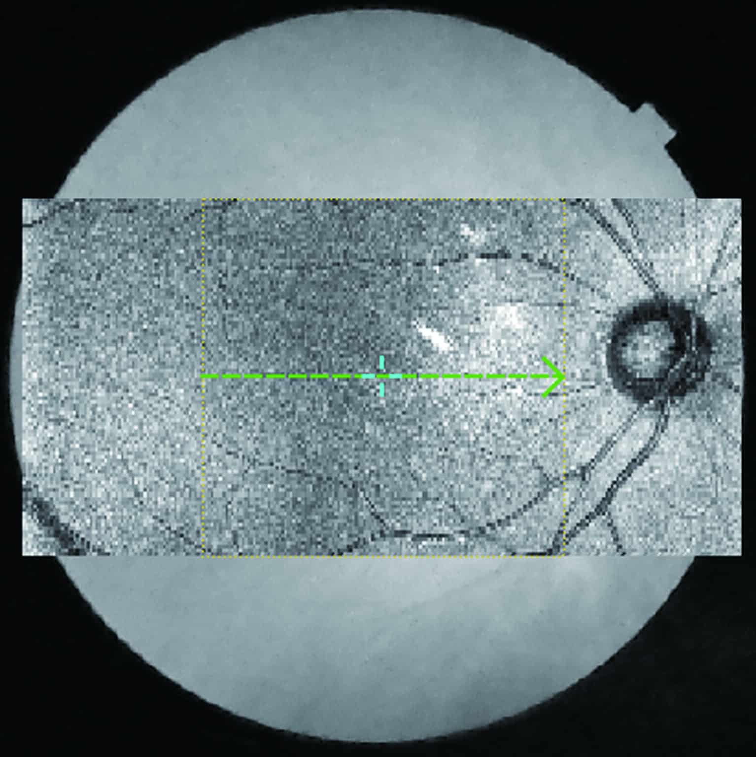 OCT500 Advanced Robotic OCT - Essilor Instruments USA
