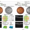 OCT500 Advanced Robotic OCT - Essilor Instruments USA