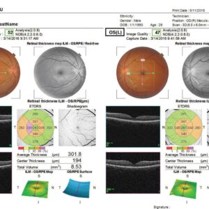 OCT500 Advanced Robotic OCT - Essilor Instruments USA