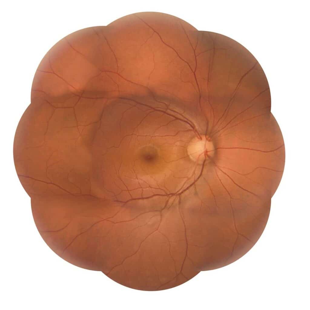 OCT500 Advanced Robotic OCT - Essilor Instruments USA