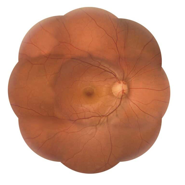 OCT500 Advanced Robotic OCT - Essilor Instruments USA