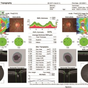 OCT500 Advanced Robotic OCT - Essilor Instruments USA