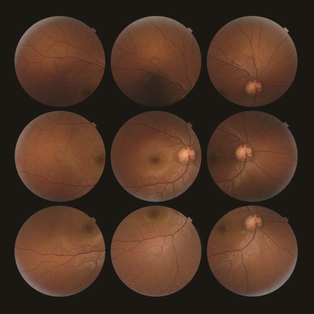 OCT500 Advanced Robotic OCT - Essilor Instruments USA