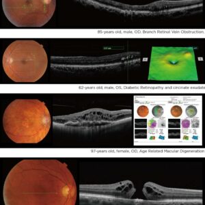 OCT500 Advanced Robotic OCT - Essilor Instruments USA