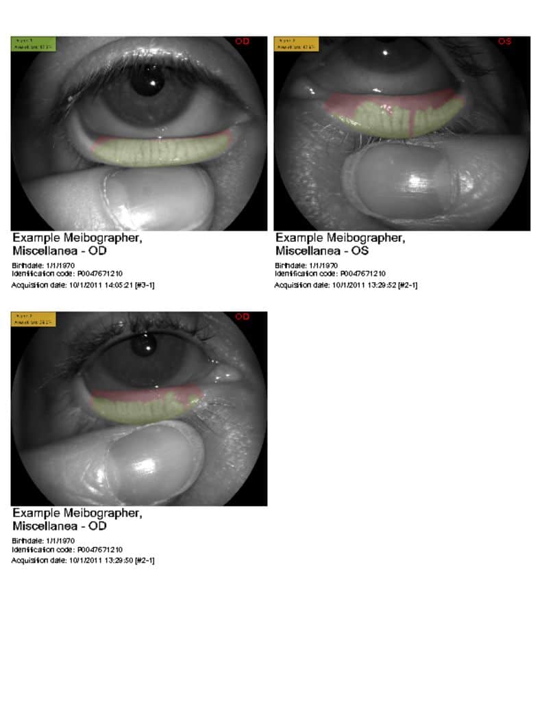 CORNEA550 Corneal Topographer - Essilor Instruments USA
