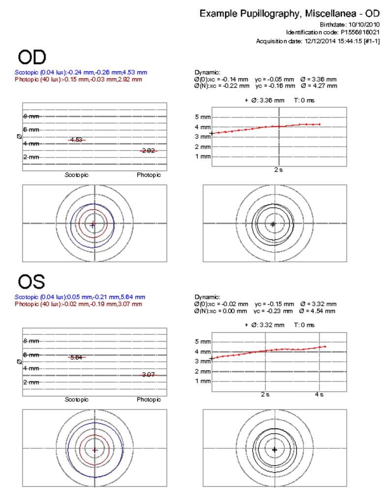 CORNEA550 Corneal Topographer - Essilor Instruments USA