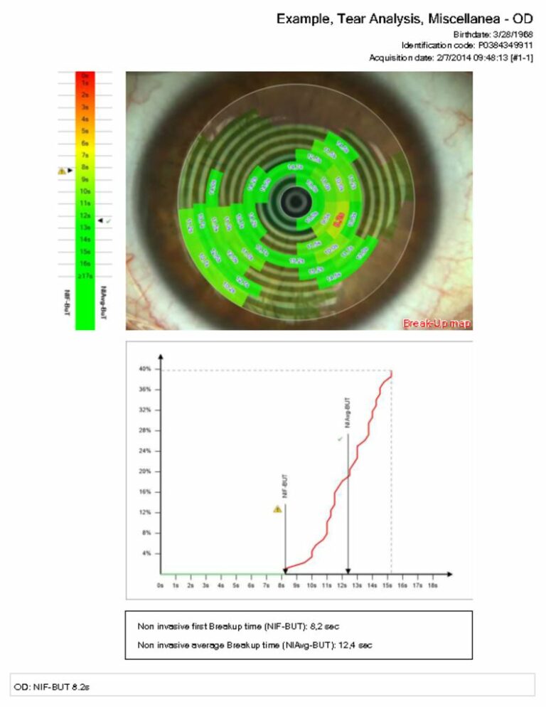 CORNEA550 Corneal Topographer - Essilor Instruments USA