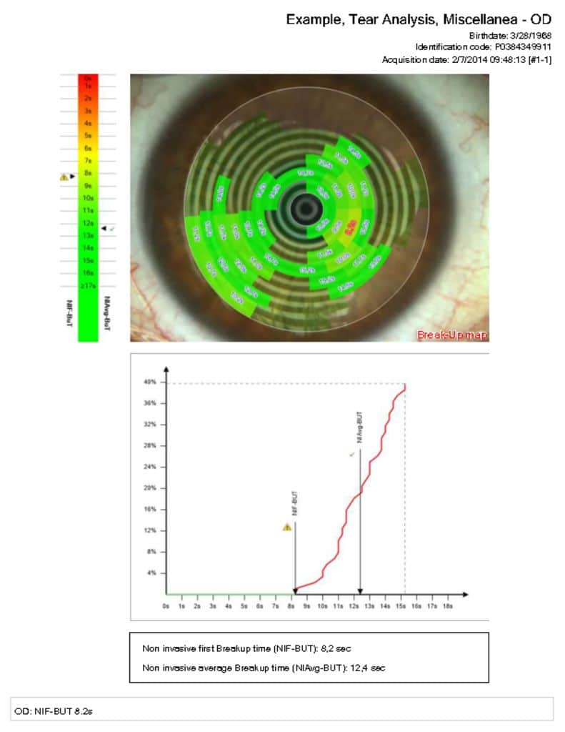 CORNEA550 Corneal Topographer - Essilor Instruments USA