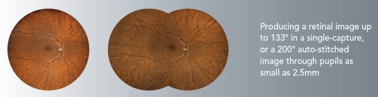 Cellview Imaging - WRI-1 Retinal Imager - Essilor Instruments USA